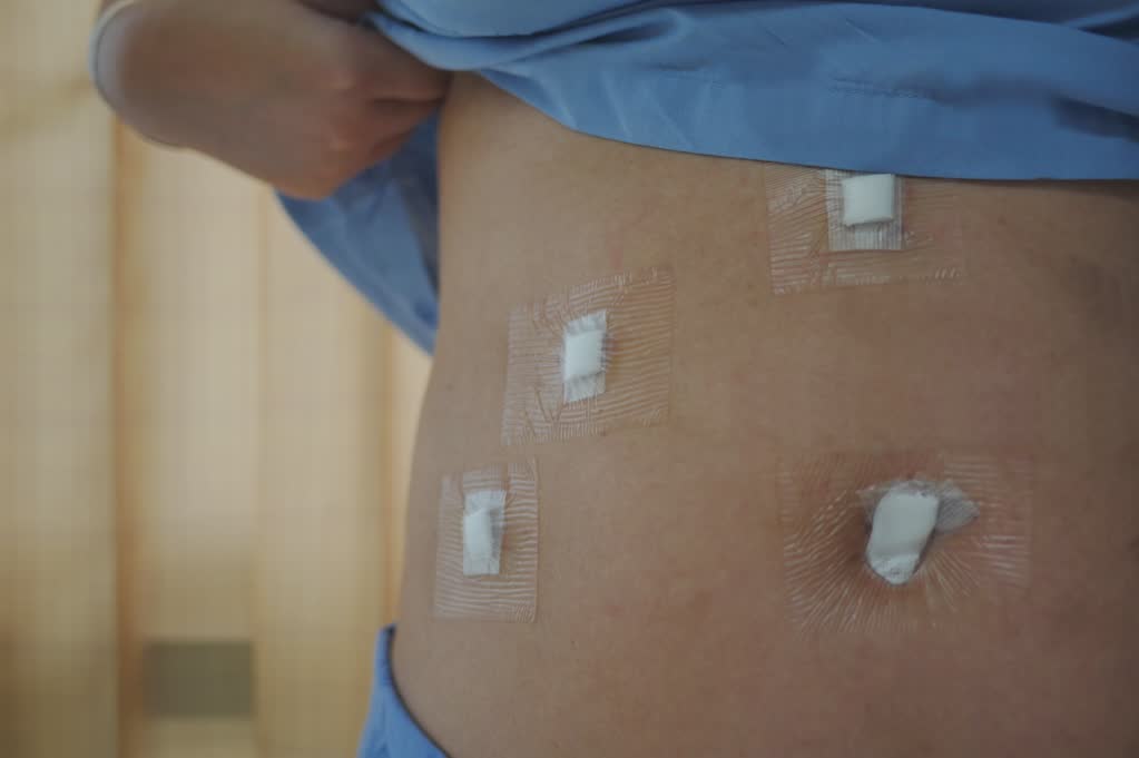 Bowel Movements Archives Weight Loss Surgery Information Bowel Movements Archives Weight Loss Surgery Information